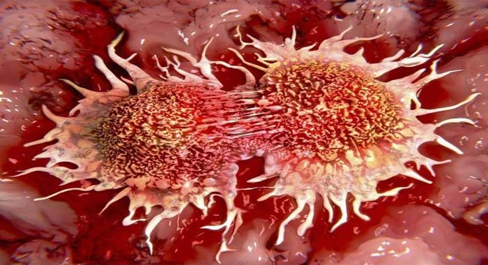 Científicos pueden haber encontrado una manera de detener la metástasis